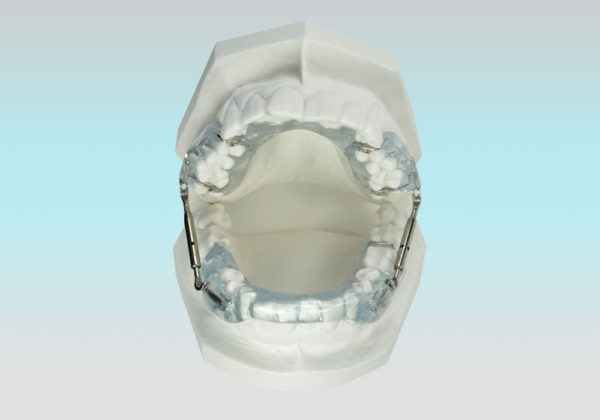 PUL Concept | Laboratorios de Ortodoncia Tecnodent